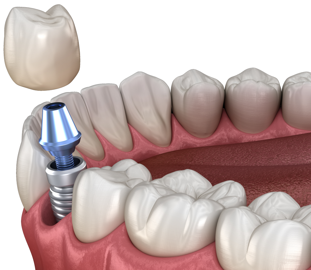 Dr. Yasin Aktas - Zahnmedizin am Rahmer See | Zahnarzt in Duisburg